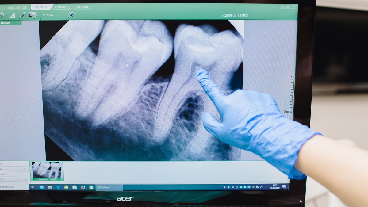 A New Tooth-Regrowing Drug Targets the Protein That Keeps Teeth From ...